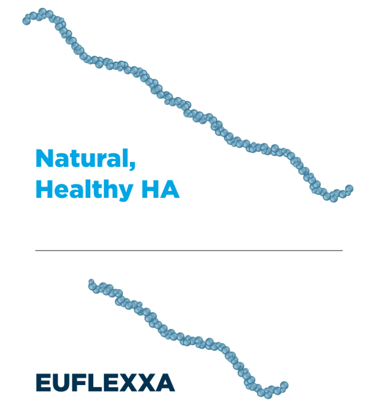 About EUFLEXXA – Euflexxa